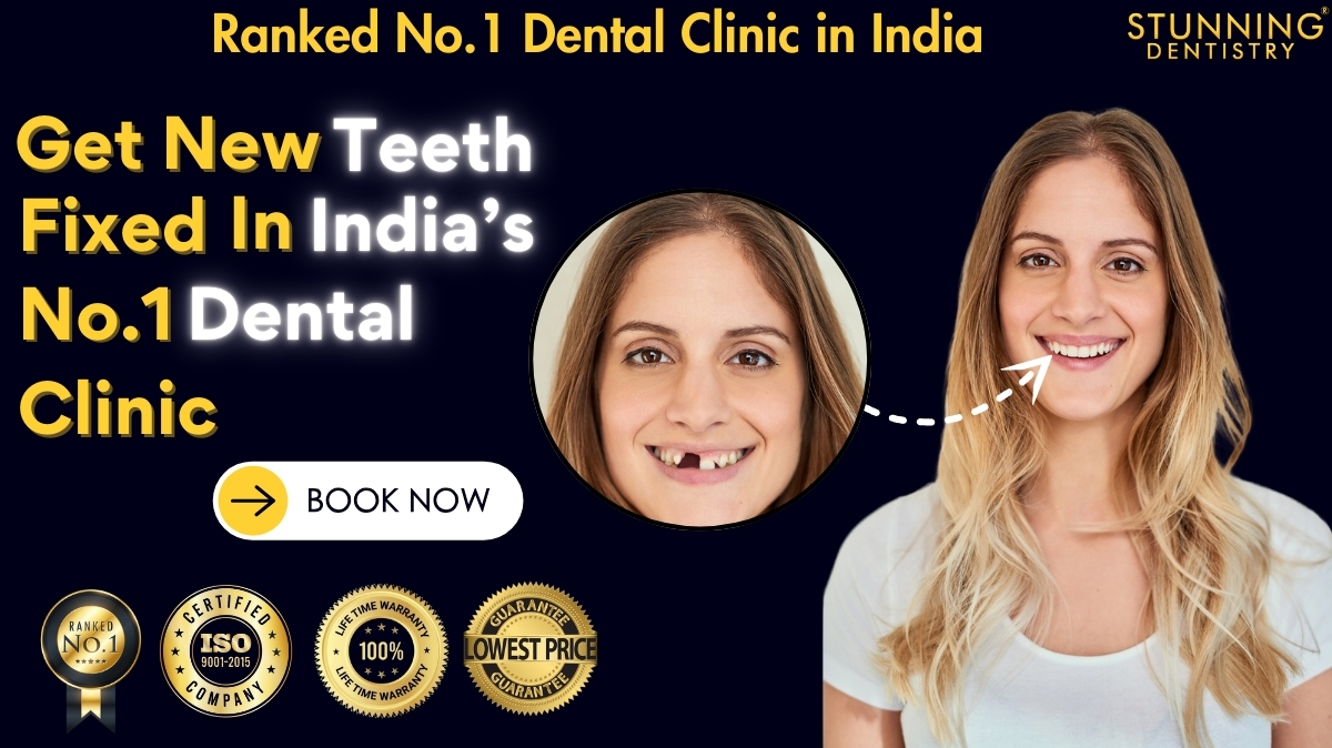 Dental Implants: The Ultimate Guide for a Permanent Smile Solution ...